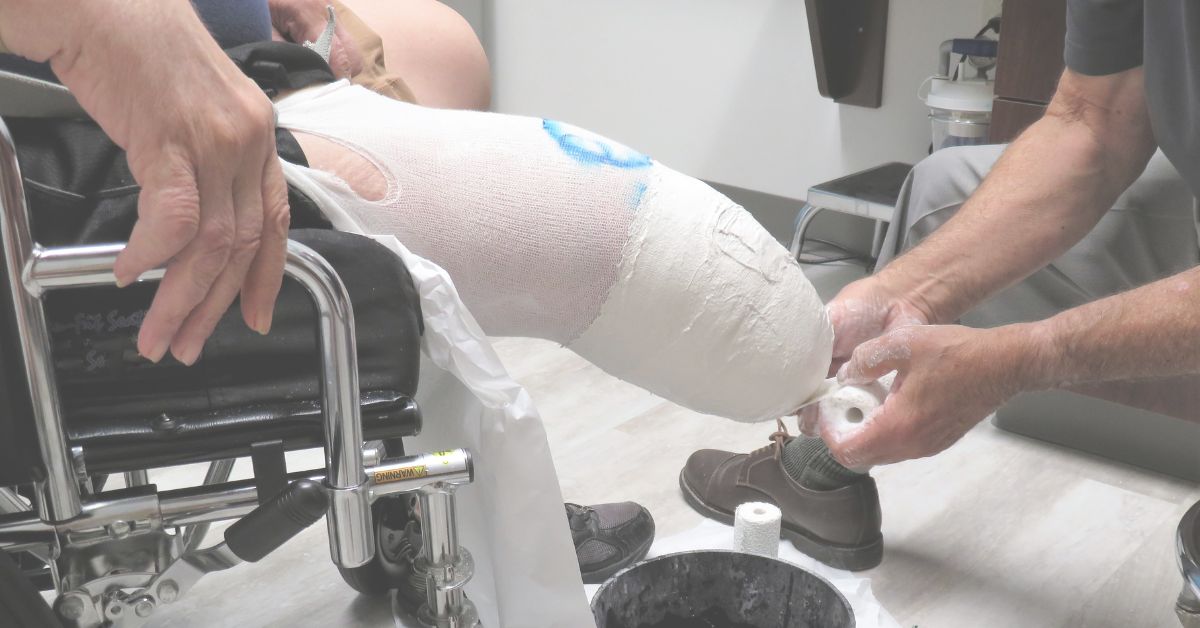Understanding Amputation Injuries