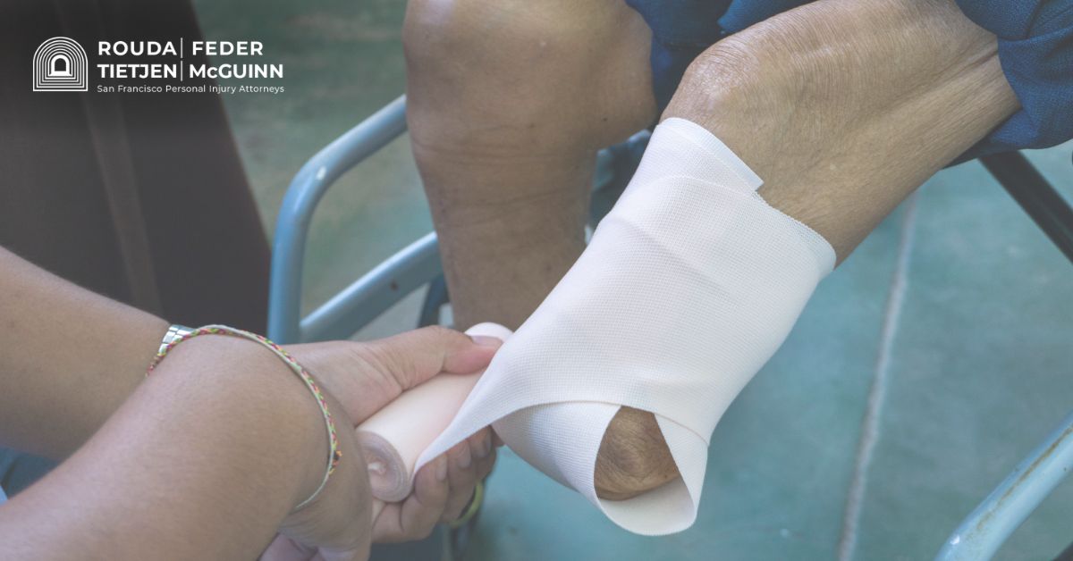 Common Myths About Amputation Injuries Debunked