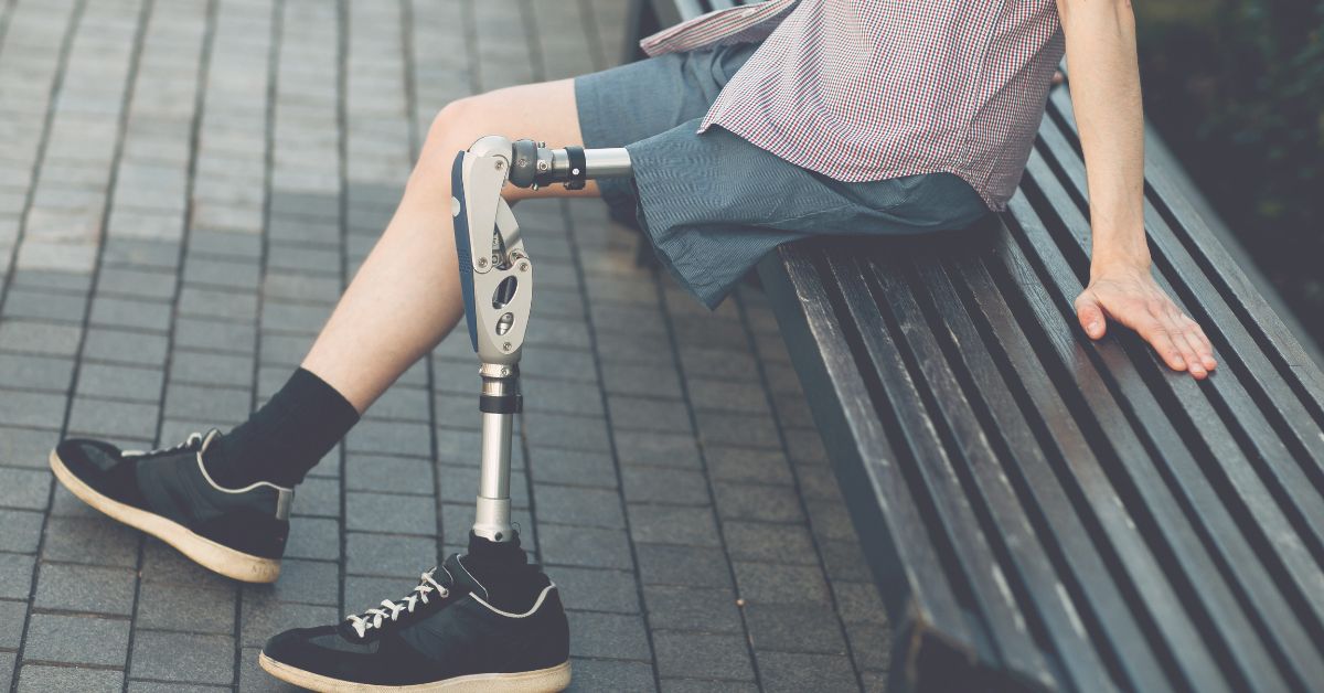 Prosthetics and Assistive Devices for Amputees: What Are Your Options?