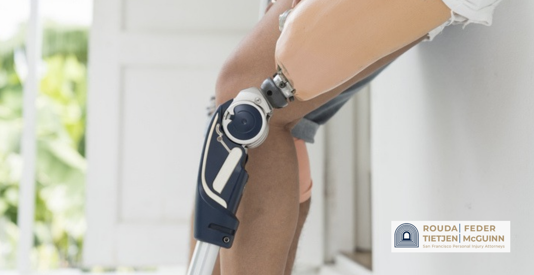 The Impact of an Amputation Injury